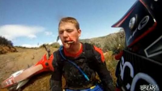 Motocross Rider Falls and Gets a Branch Through His Face | VladTV