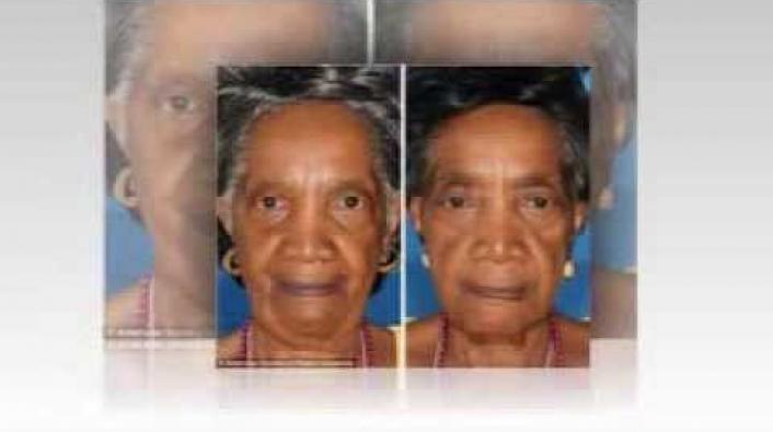 Identical Twins Show Aging Effects of Smoking | VladTV