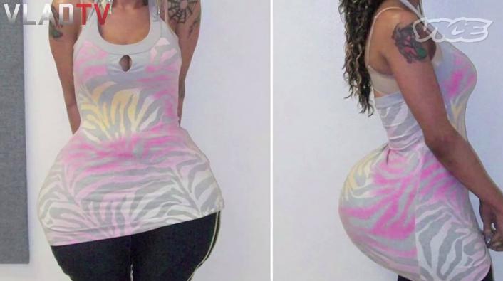 "Buttloads of Pain" Makes You Think Twice About Booty Implants