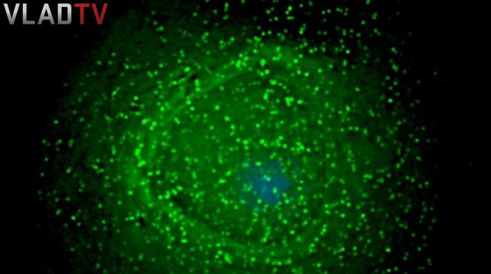 'Bugchasing' Fetish Emerges For People Who Want To Catch HIV