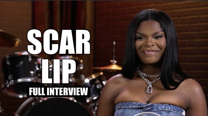Exclusive Scar Lip On Receiving Lip Scar From Brother 800k Offer Swizz Beatz Boosie Shaq